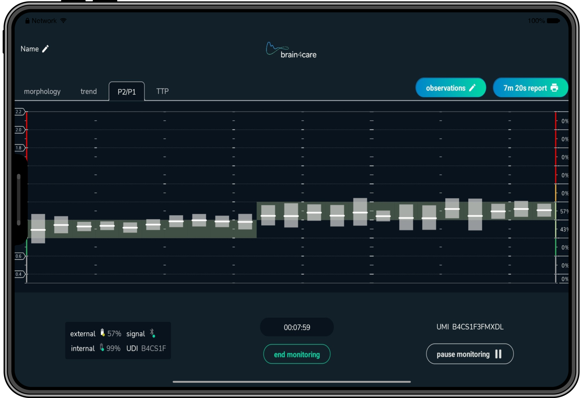 solution | brain4care
